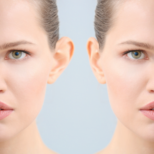 Ear Shape Correction In Andheri, Mumbai | Sculpt Sublime Clinic