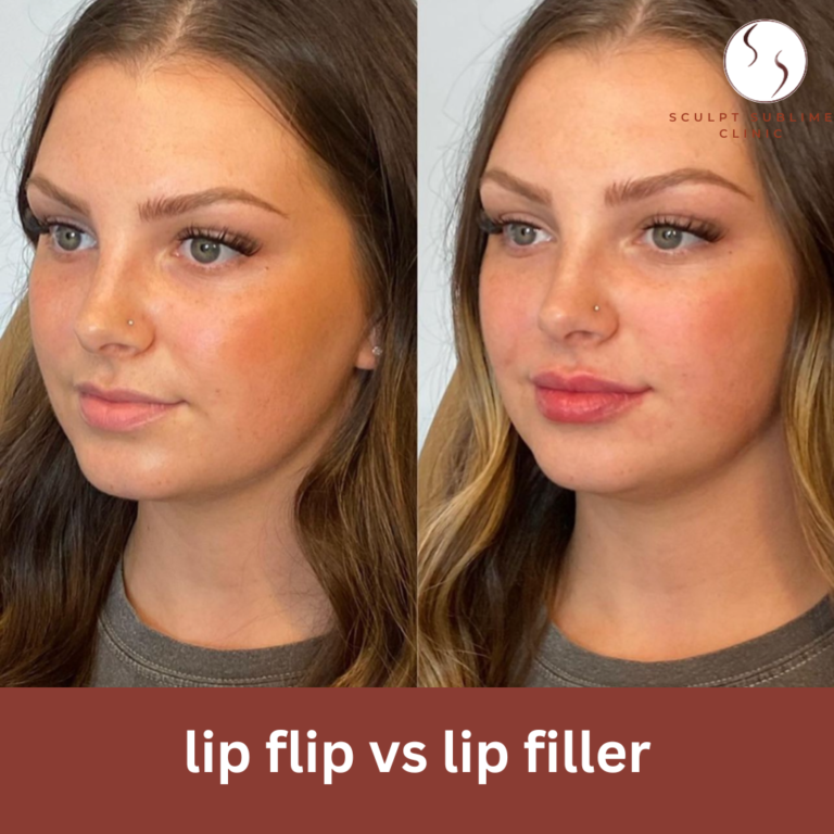 Lip Flip vs Lip Filler: Key Differences